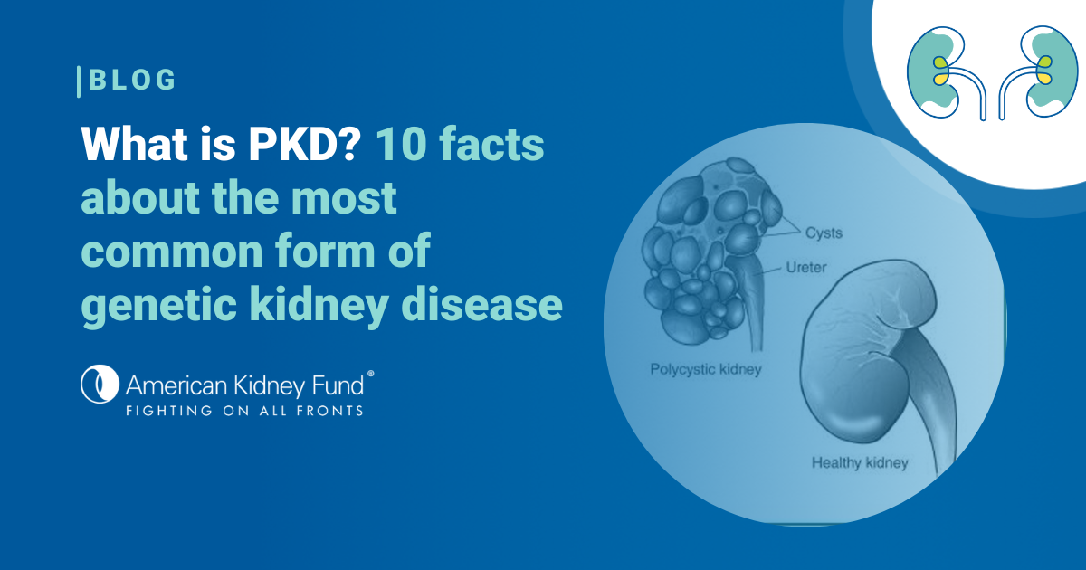 What is PKD? 10 facts about the most common form of genetic kidney ...